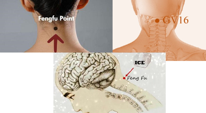 Terapia cu gheață aplicată pe punctul de acupunctură Feng Fu – UNIUNE ...